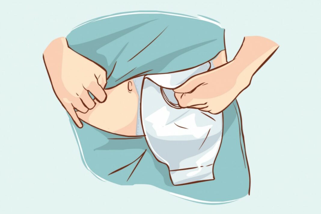 Ostomy Care 101: Tips and Best Practices for Maintenance and Hygiene